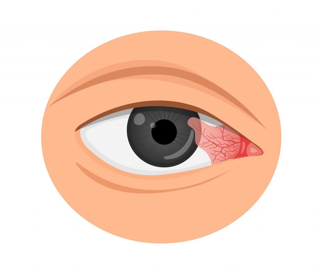 10 Most Common Eye Infections: Everyone Should Know